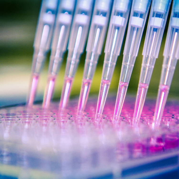 Metatranscriptomics - CosmosID